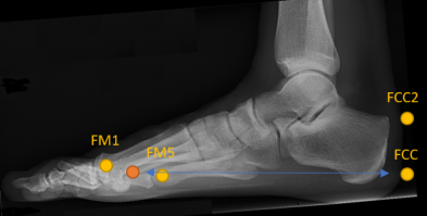 Appendix D - Oxford Foot Model