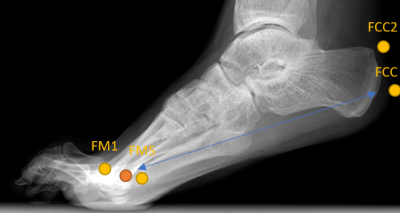 Appendix D - Oxford Foot Model