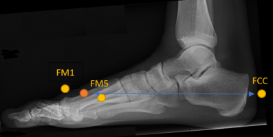 Appendix D - Oxford Foot Model