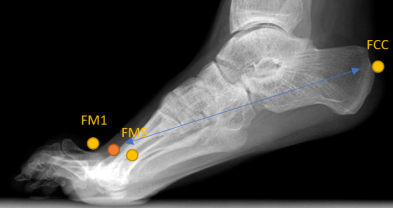 Appendix D - Oxford Foot Model